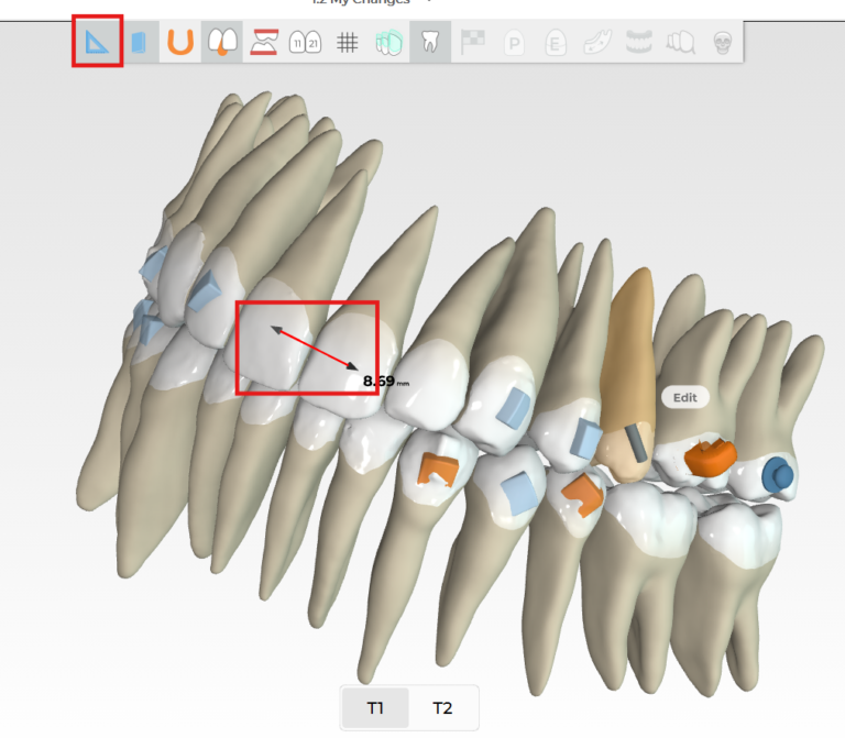 Spark release - Ormco