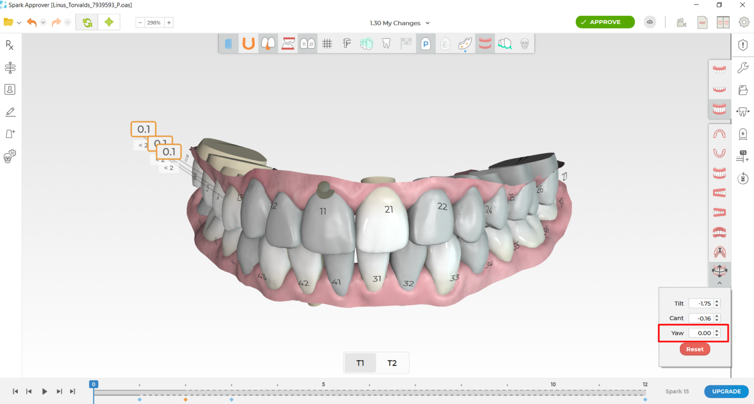 Spark release - Ormco