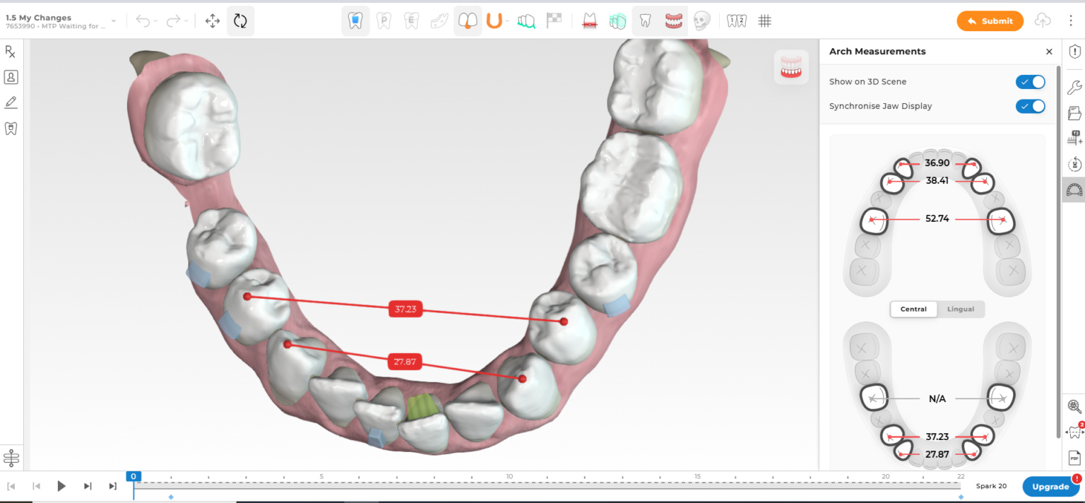 Spark release - Ormco