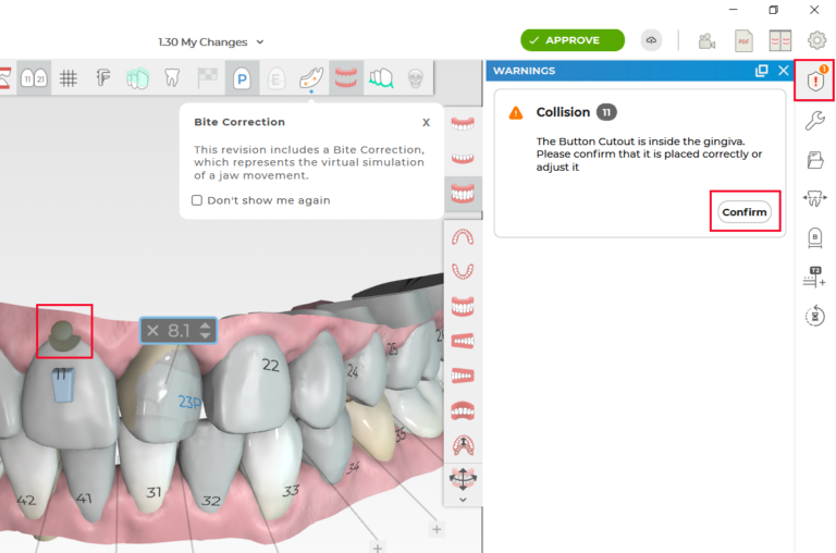 Spark release - Ormco