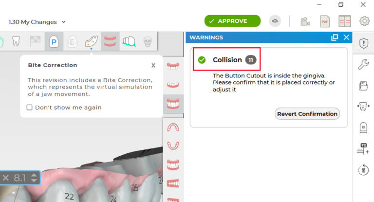 Spark release - Ormco